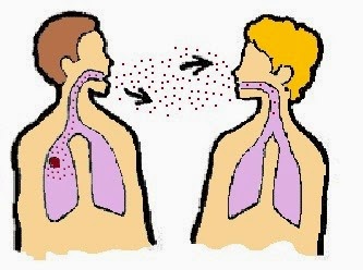 TUBERCULOSIS: Definición, epidemiología y transmisión