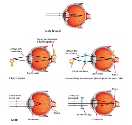 Sistem Penglihatan Pada Manusia - MaoliOka