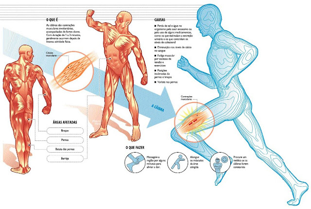 TREINAMENTO ESPORTIVO: Câimbras: quais são as causas e como evitá-las?