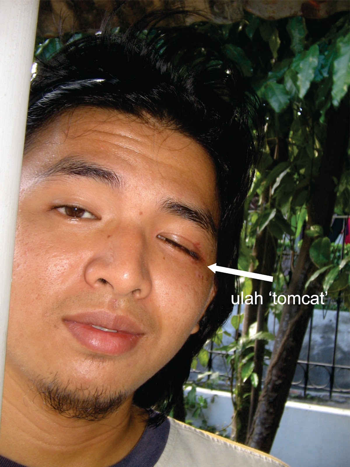 rifqi nur hidayat: Obat Serangan Serangga Tomcat