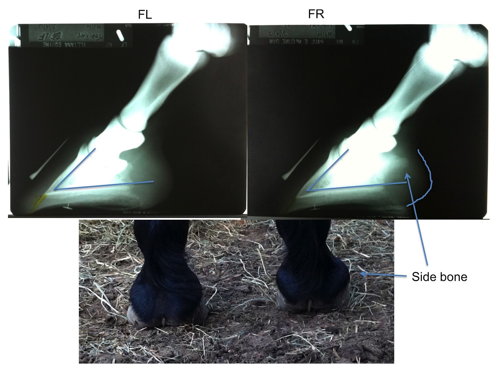 journey to better hooves: Sidebone