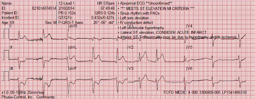 Cool Cardiology Cases!: Widowmaker!
