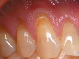 Do You Know About Dental care