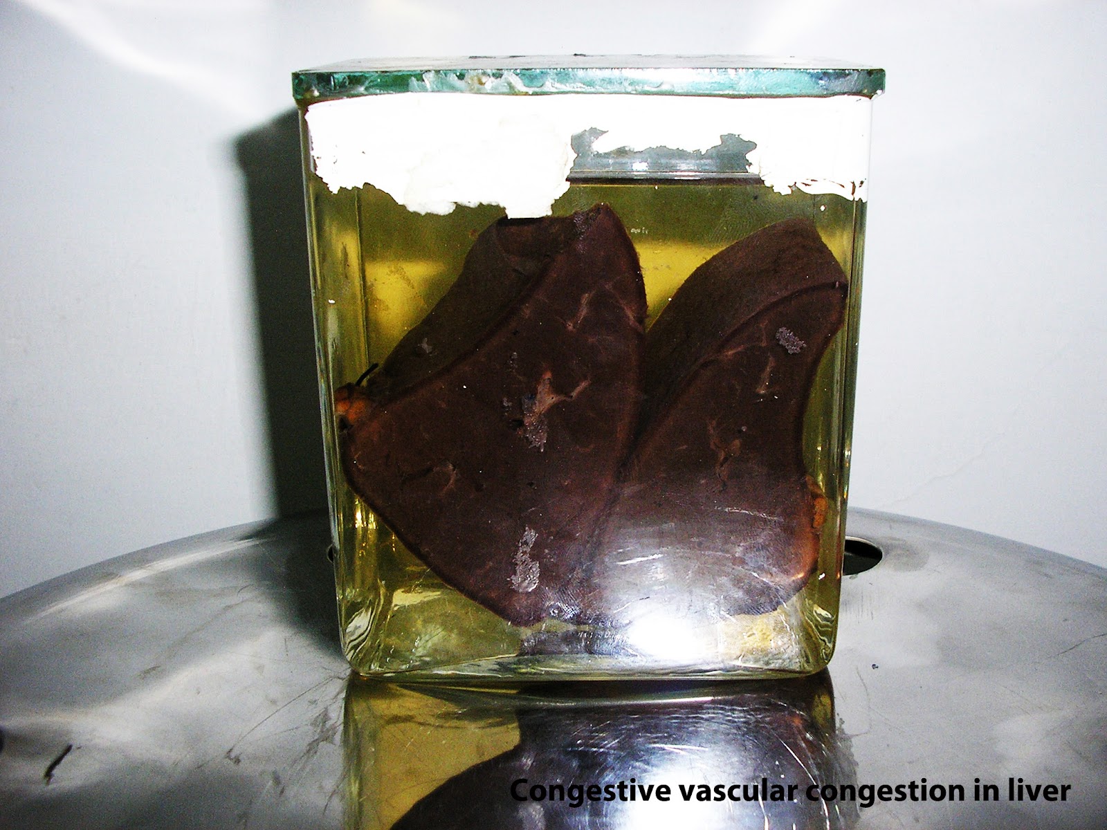 Medical Education for Students: Gross Specimens General Pathology (50 ...