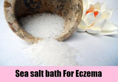 Living With Nickel & Iron Oxide Allergies: Sea Salt for Eczema and ...
