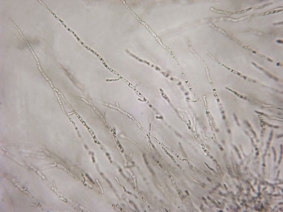 Fun With Microbiology (What's Buggin' You?): Trichosporon species