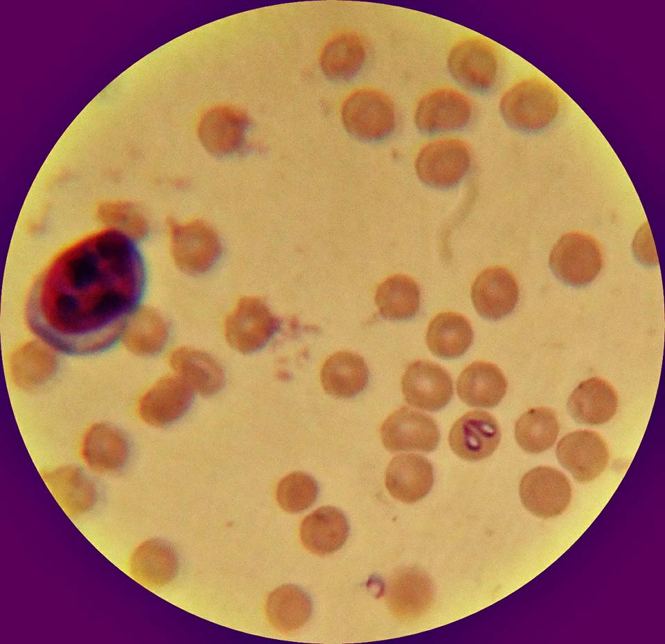 VETERINARY PARASITOLOGY: BABESIOSIS