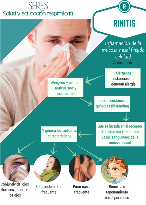 Academia del pulmón: RINITIS, tan común como subestimada