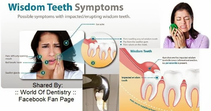 :: World Of Dentistry ::: Wisdom Teeth Pain and Other Common Symptoms