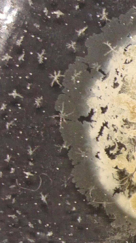 Candida albicans pe mediu de cultura sabouraud cu probe de piele cu ...