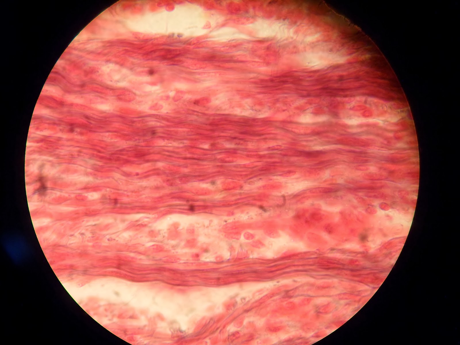 Ourlad's Paradigm: Connective Tissue