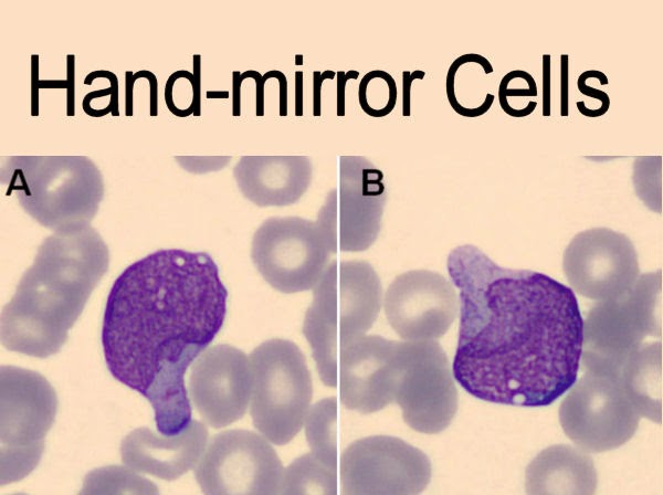 Medical Laboratory and Biomedical Science: Magic hand-mirror cells