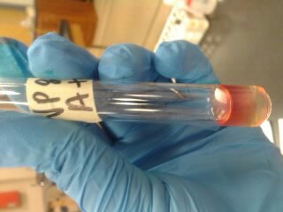 Microbiology EJournal: Day 31-Ran the VP test on both Bacterias and ...