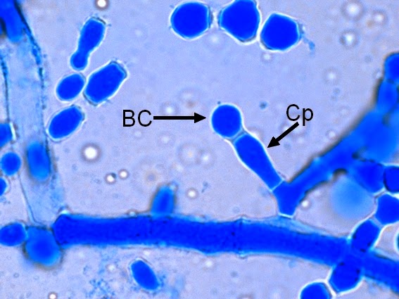 Fun With Microbiology (What's Buggin' You?): Chrysonilia sitophila