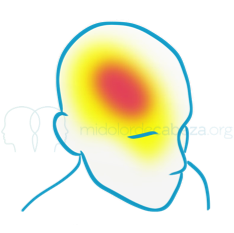 CEFALEAS: Clasificación II