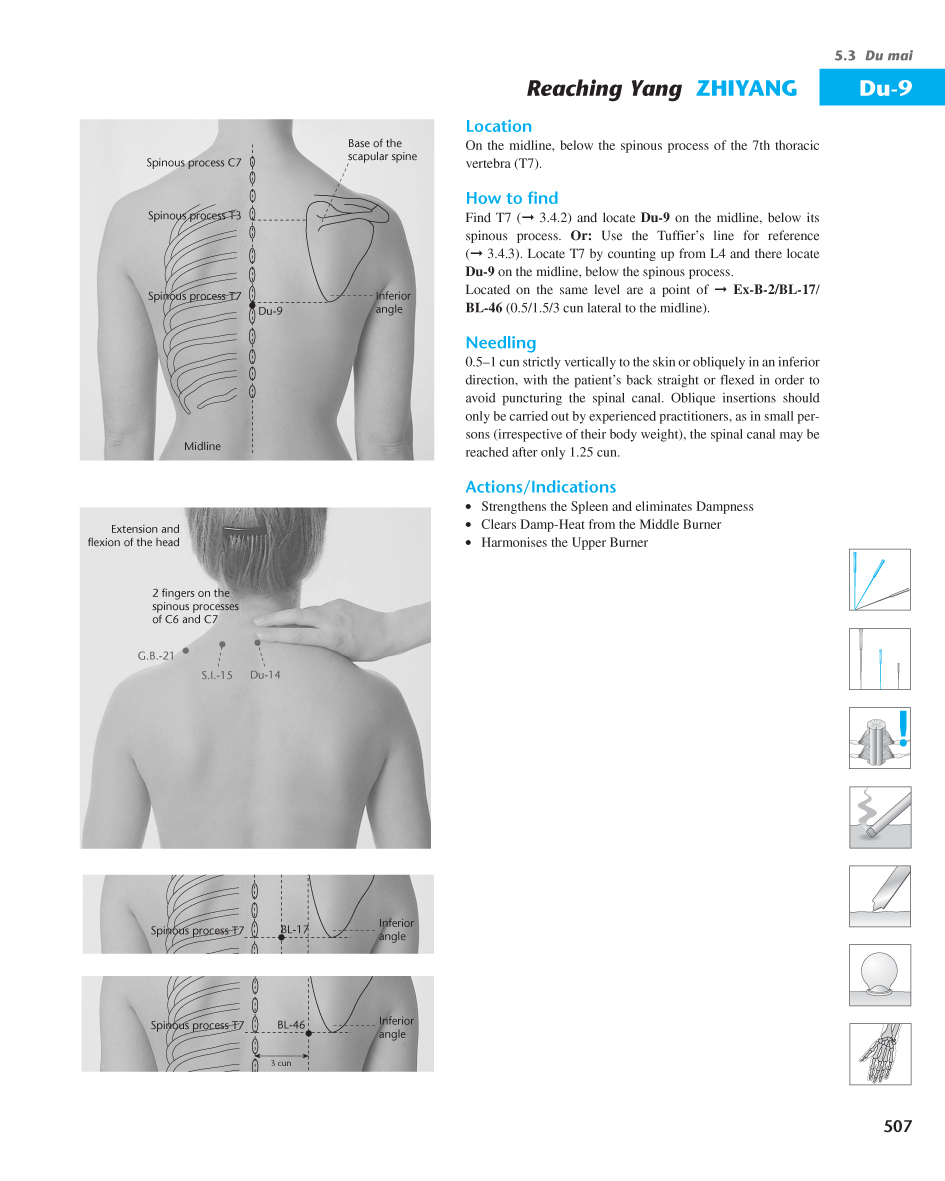 Acupuncture Masters: Acupuncture Points Database - Du Channel