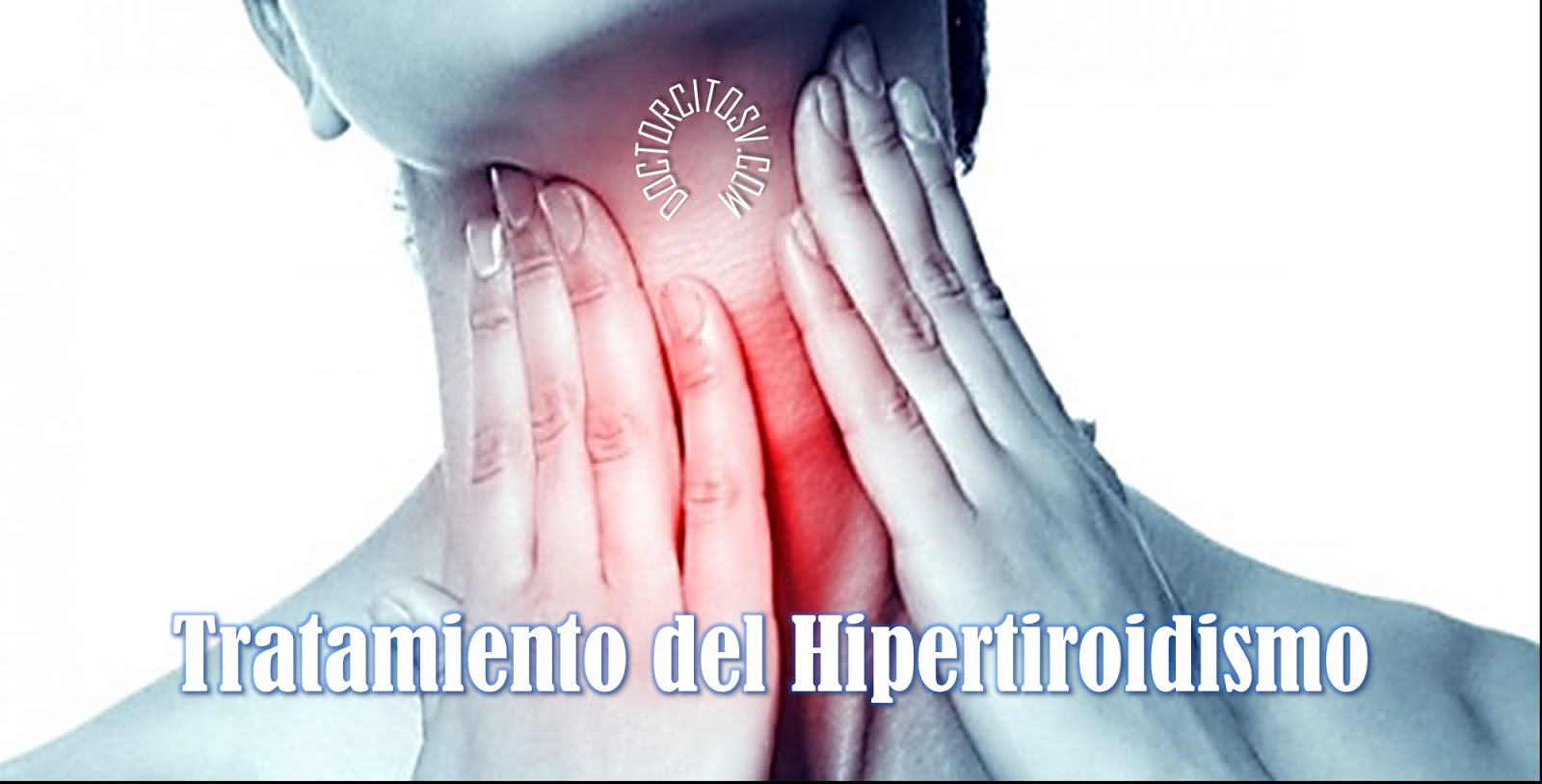 DOCTORCITO: Tratamiento de Hipertiroidismo