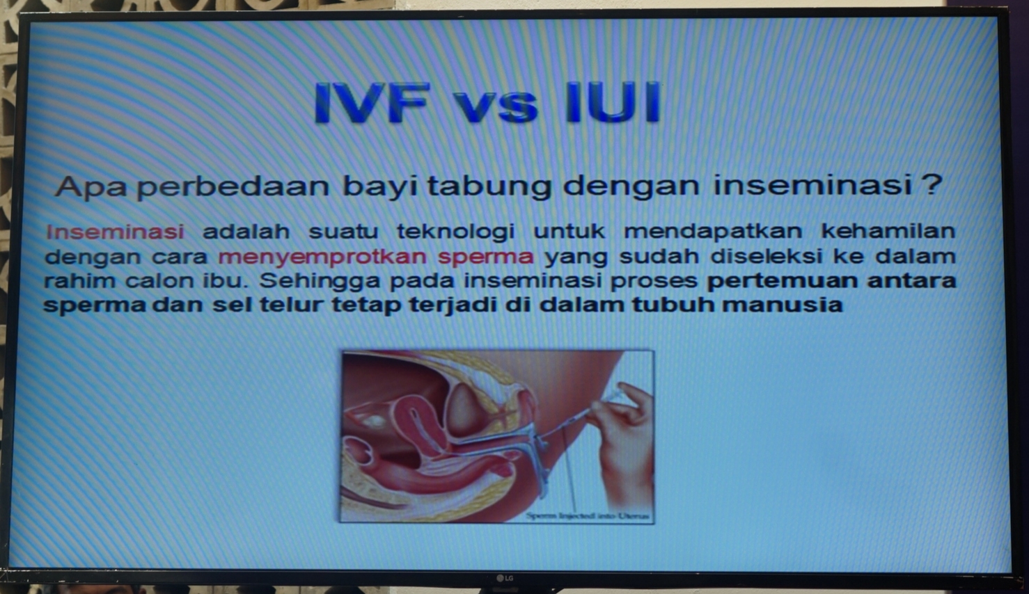 Proses Bayi Tabung, sebagai pilihan terapi masalah kesuburan | Roswitha ...