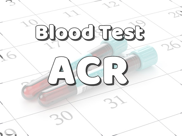 ما هو تحليل ACR - لابِكس