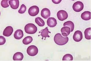 HEMATOLOGÍA: Serie Roja