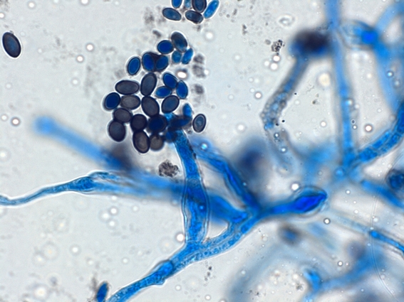 Fun With Microbiology (What's Buggin' You?): Stachybotrys species