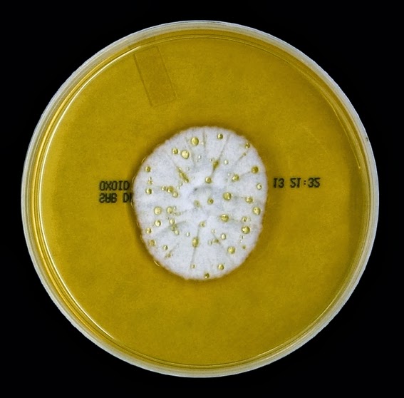 Fun With Microbiology (What's Buggin' You?): Trichophyton terrestre