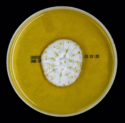 Fun With Microbiology (What's Buggin' You?): Trichophyton terrestre