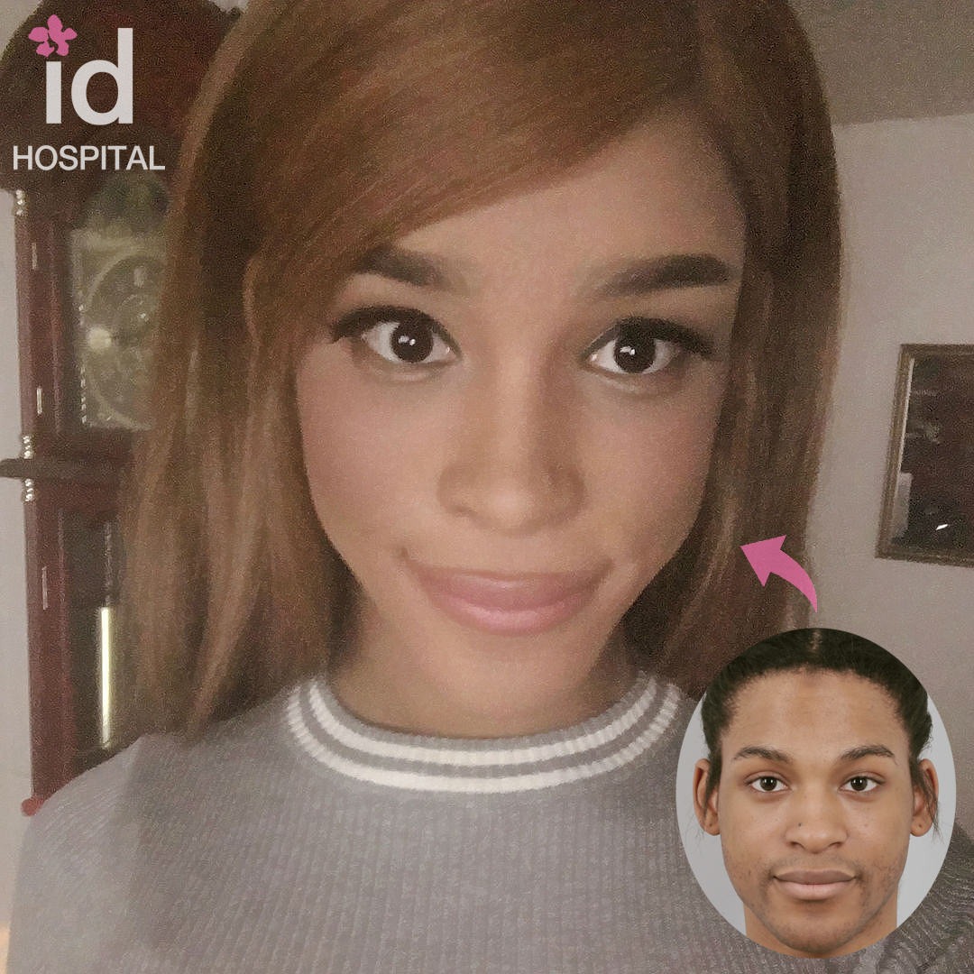 ID Hospital Korea: [ID Hospital Korea Experiences] Echo's before and ...