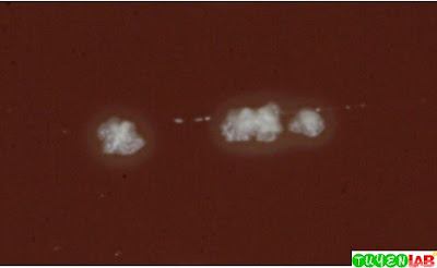 [Microbiology] Atlas of Anaerobes of Clinical Importance | Free Medical ...