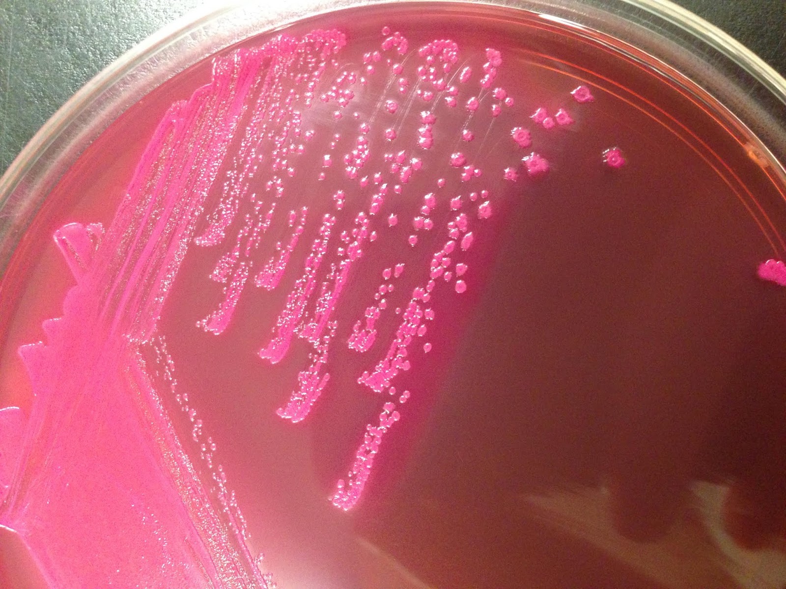 O que são as Enterobacterias ? - Análises Clínicas.com