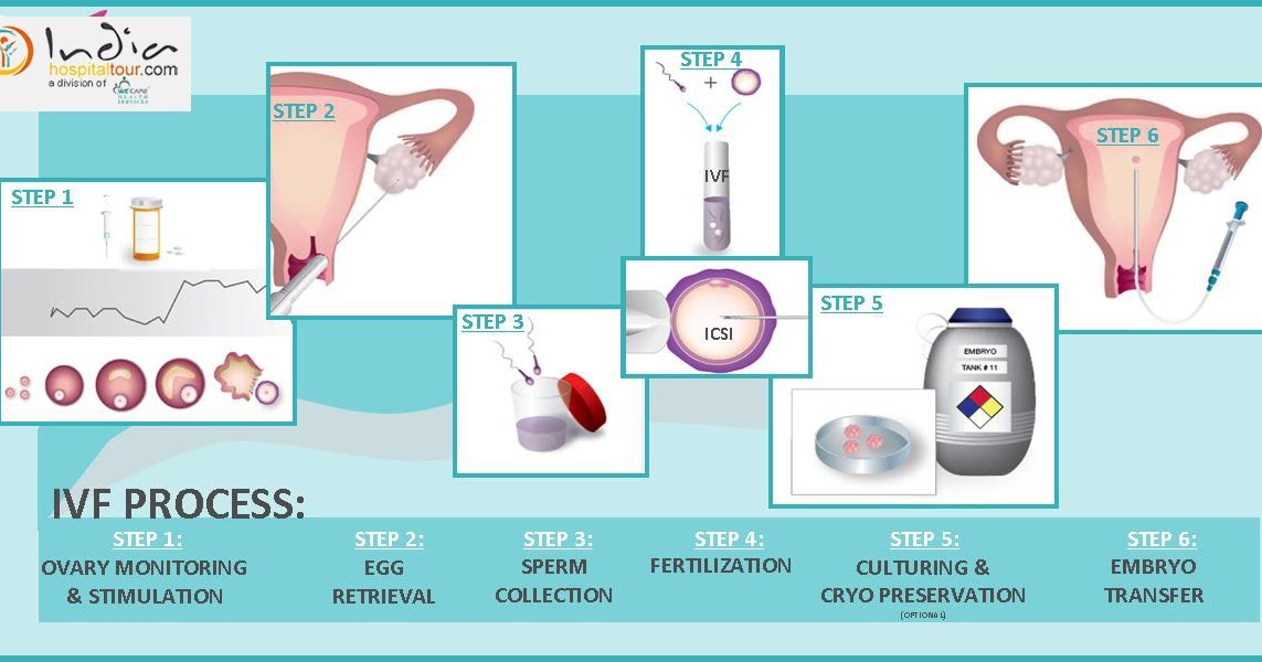 IVF Treatment Process in India – For Couples struggling with infertility