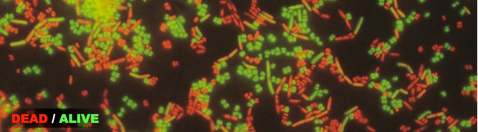 Schrödinger’s microbes: Tools for distinguishing the living from the ...