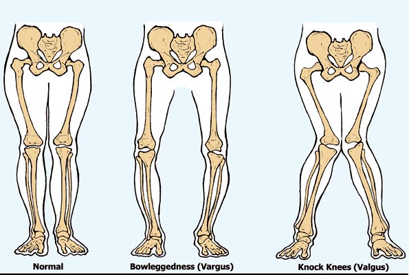 V-Care Clinic: September 2015