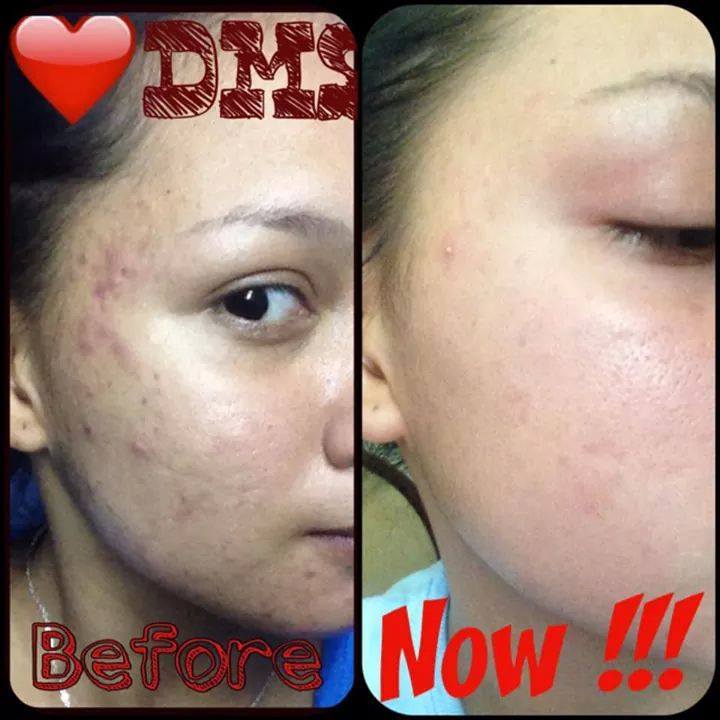 RANGKAIAN PRODUK DERMAX SUPERSKIN (DMS) - ISTIMEWA DAN TERBAIK UNTUK ANDA