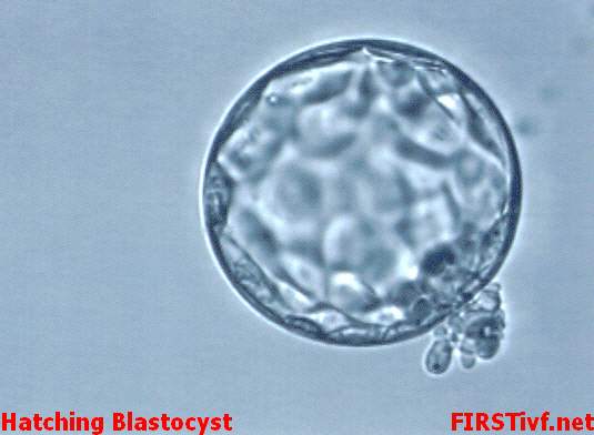Our journey - From conception to now.: Day 5 post embryo transfer