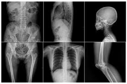 Fisika Makin Asyik: FISIKA KESEHATAN