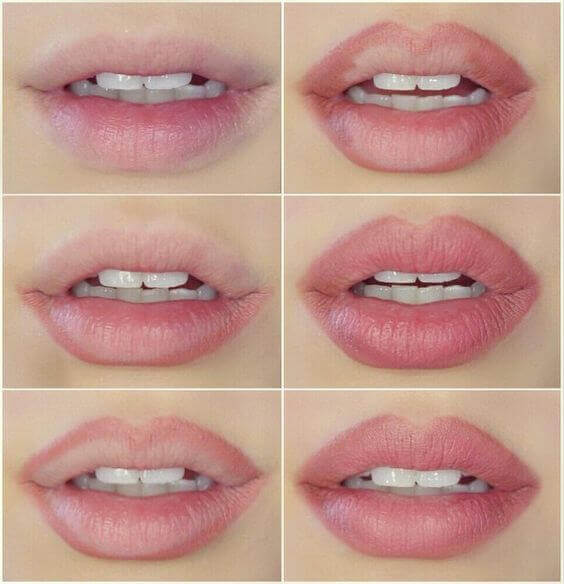 Thin Lips Are Ugly