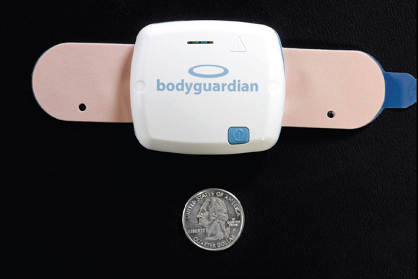 Tisg_IB_AE : Análisis del BodyGuardian