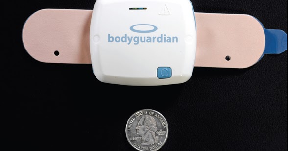 Tisg_IB_AE : Análisis del BodyGuardian