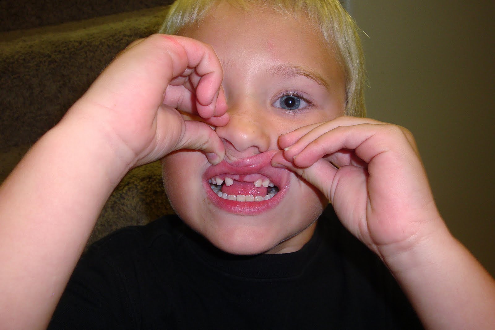 ELLINGSON: Snaggle Tooth