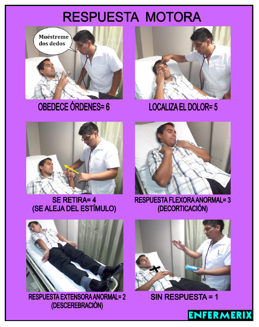 Cuidados Enfermeros Intensivos: Escala de coma de Glasgow