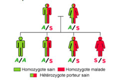 TPE, la drépanocytose: Déterminer la maladie