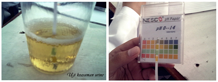 Uji Kandungan Urin ~ Advanced Insight