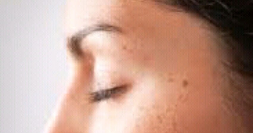 health and beauty tips: Easily get rid from face moles with home remedies