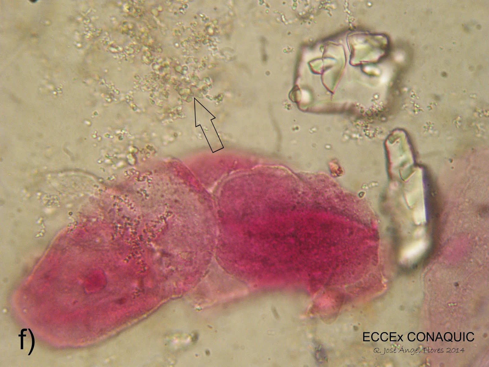 Granulações De Uratos Amorfos - RETOEDU