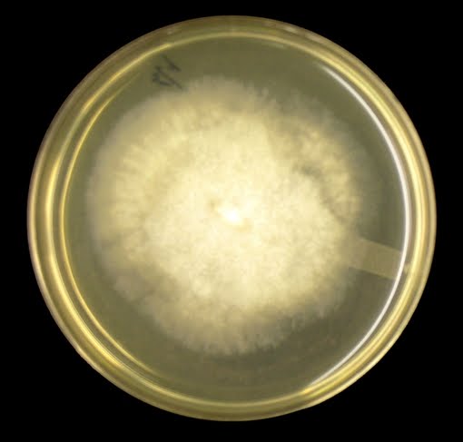 Fun With Microbiology (What's Buggin' You?): Mucor Species