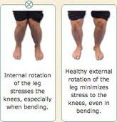 Strength On Demand: Flat Feet and Knee Pain