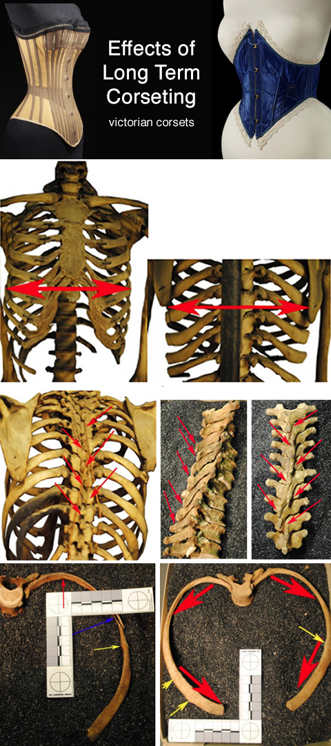 A influência do uso do corset na morfologia de suas usuárias no período ...