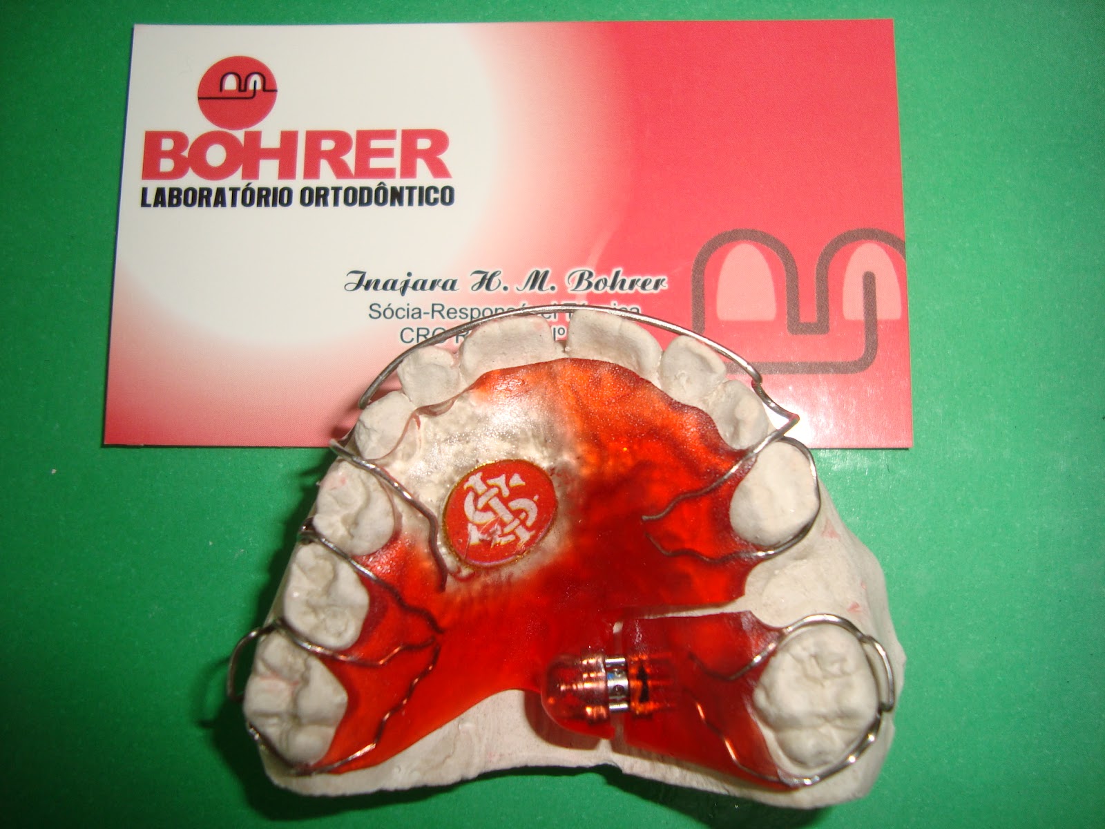 Laboratório Ortodôntico Bohrer: PLACA ATIVA COM PARAFUSO EXPANSOR ...