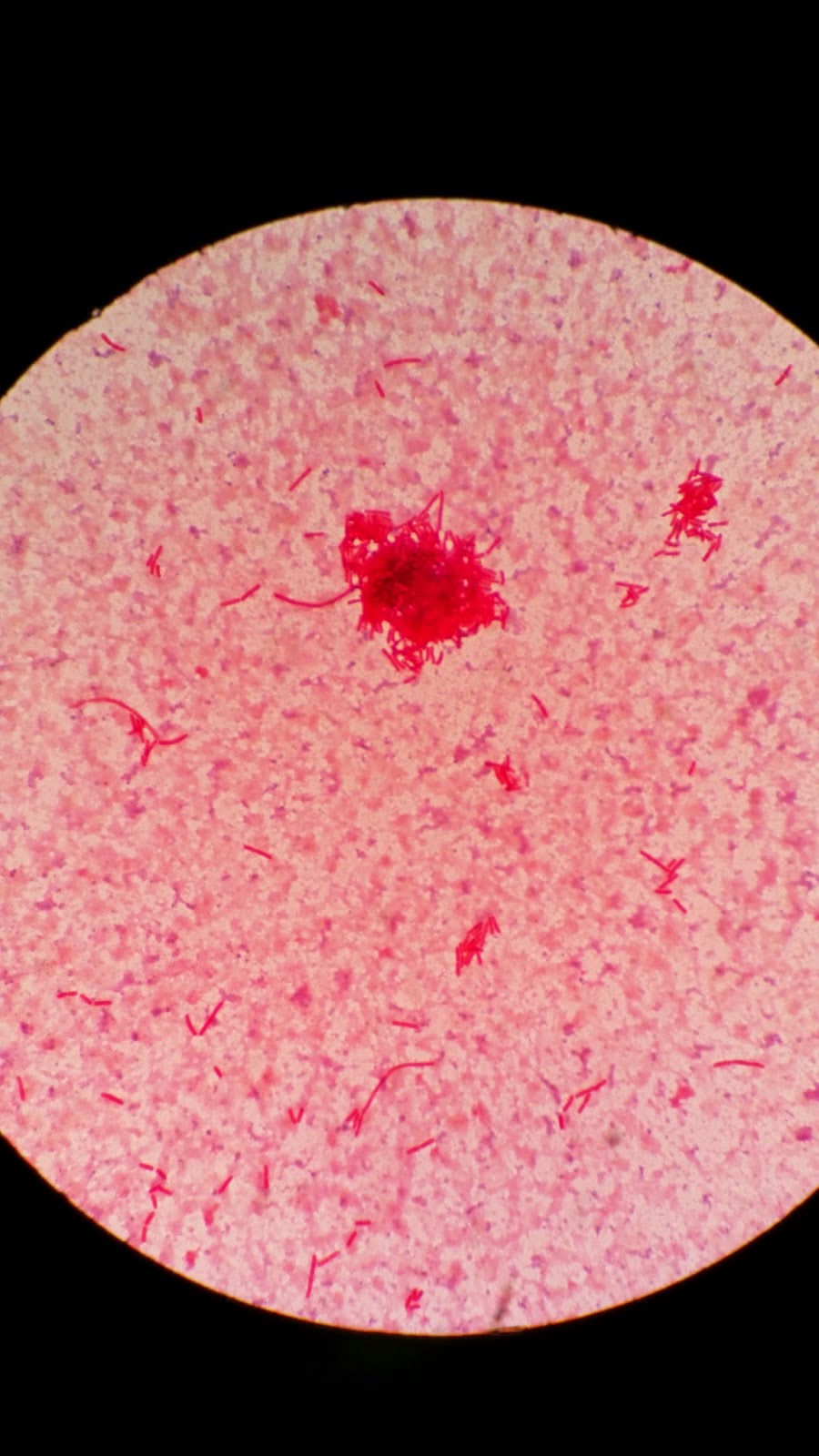 Salmonella Spp